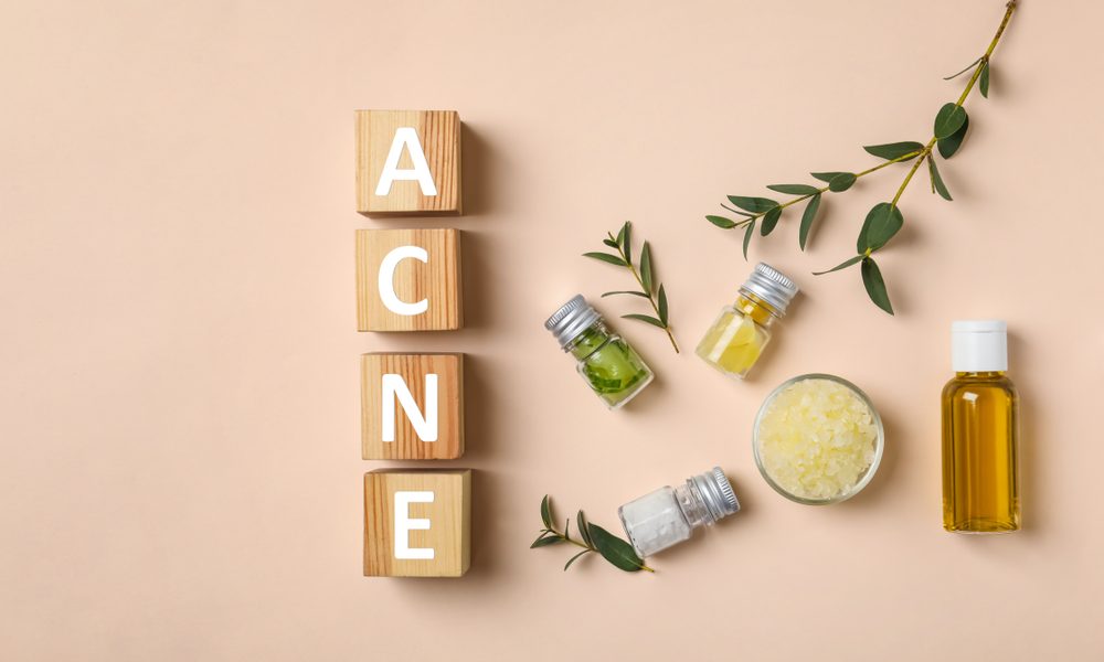 Top 15 Effective Home Remedies for Acne This 2020 That Actually Work